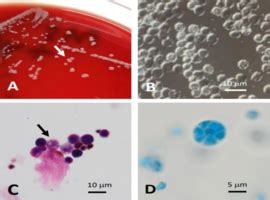 Prototheca Wickerhamii Algaemia In A Renal Transplant Recipient