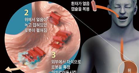 If 과학이 된 종이접기 몸속부터 우주까지 활약