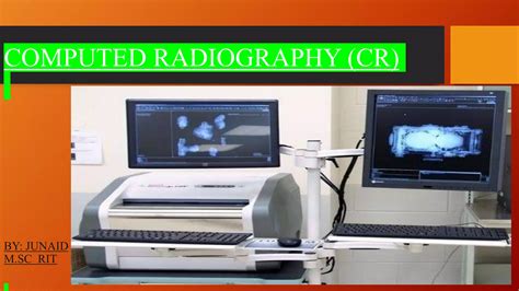 Cr Computed Radiography System Pptx