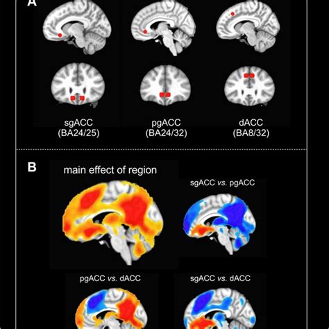 Regions Of Interest Rois And Resting State Functional Connectivity