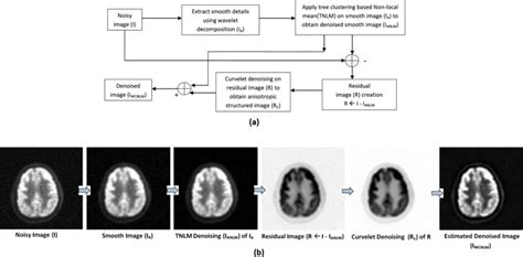 Block Diagram Of Proposed Denoising Model A Several Steps Of The
