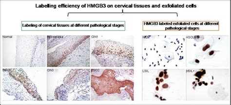 Researchers Develop New Technology For Early Detection Of Precancerous