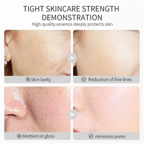 세나나 미백 및 주근깨 제거 에센스 모이스처라이징 주름 방지 미세 모공 에센스 페이셜 스킨 케어 15ml 스킨케어
