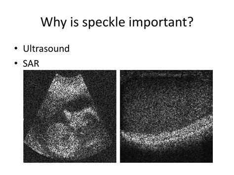 Ppt Modeling Speckle Noise In Matlab For Imaging Applications Ppt Modeling Speckle Noise In Matlab For Imaging Applications