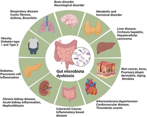 Gut Microbiota Therapy In Gastrointestinal Diseases Pmc