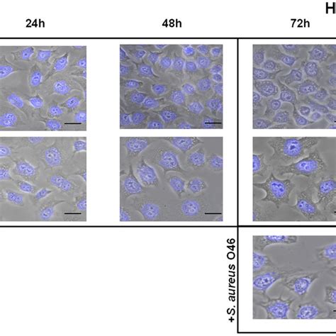 Enlargement Of Mac T Cells Exposed To S Aureus Bovine Mac T Cells Download Scientific Diagram