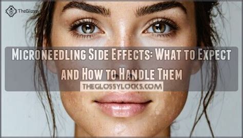 Microneedling Side Effects What To Expect And How To Handle Them
