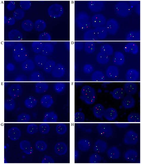 Fluorescence In Situ Hybridization