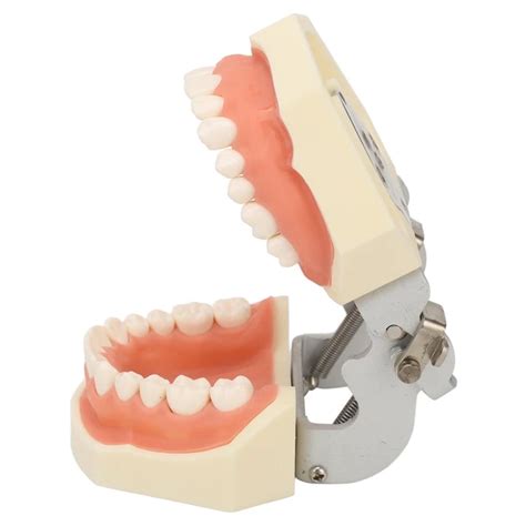 Dental Model Maxillary Cyst Dental Models Tooth Preparation Educational