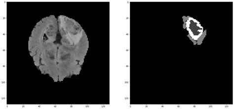 GitHub Yunyuntsai BraTS Brain Tumer Segmentation Code For Brain Tumor Segmentaion