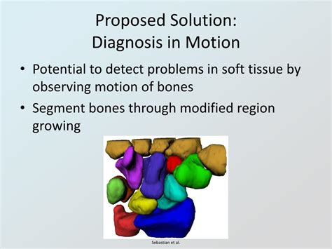 Ppt Segmentation Using Skeletally Coupled Deformable Models