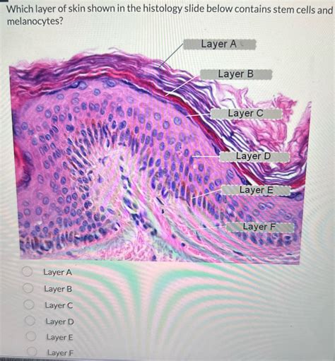 Solved Which Layer Of Skin Shown In The Histology Slide Below Curtains Course Hero