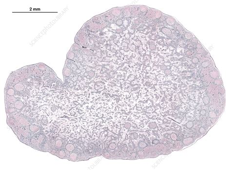 Reticular Fibres In Lymph Node Light Micrograph Stock Image C056 3727 Science Photo Library