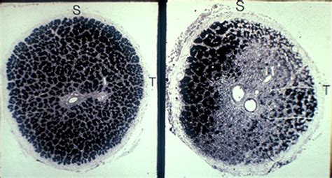 Optic Disc Assessment