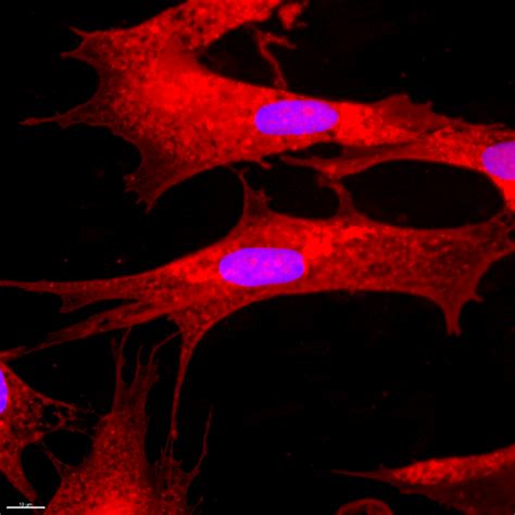 Bdr Stem Cell And Fibroblast Resource Brains For Dementia Research