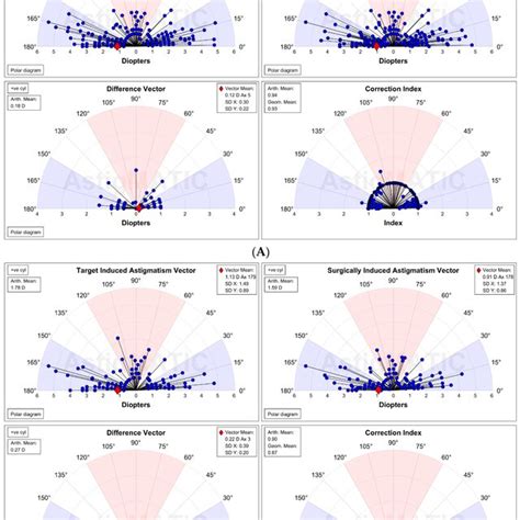 A Histogram Of Spherical Equivalent Refraction Accuracy At 12 Months