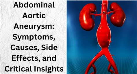 Abdominal Aortic Aneurysm Symptoms Causes Side Effects And Critical