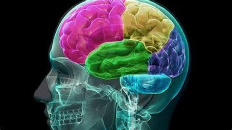 Mengenal Teknologi Dsa Dalam Penanganan Stroke Bagian 2 Otc Digest