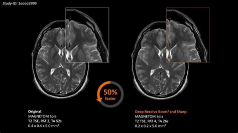 15t Mri System Magnetom Sola Get Quote Rfq Price Or Buy