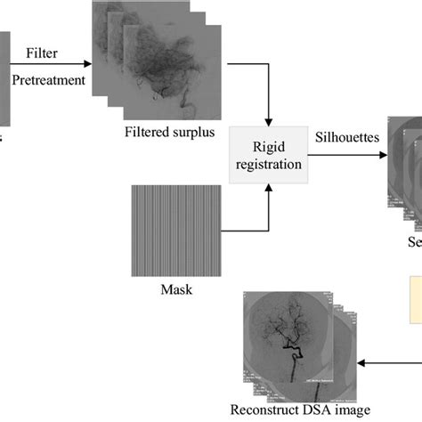 Ct Image Processing Flow Based On Biorthogonal Wavelet Filter