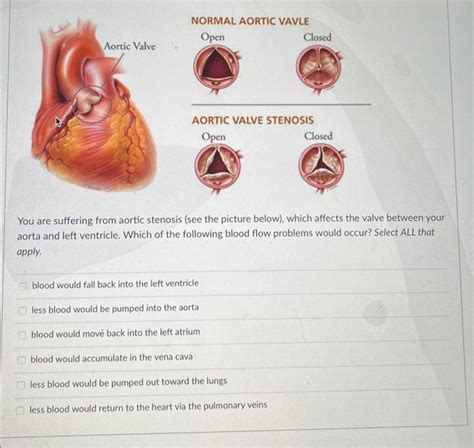 Solved Normal Aortic Vavle Aortic Valve Stenosis Closed You