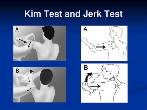 Ppt Orthopedic Special Tests For The Shoulder Powerpoint Presentation