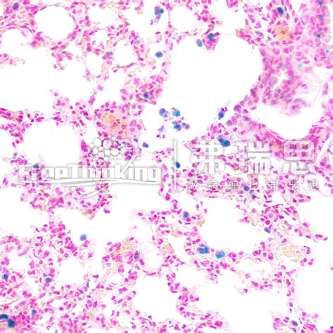 β 半乳糖苷酶染色 南京弗瑞思生物科技有限公司