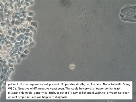 Vaginal Microscopy Summary Table B Findings Associated With Elevated Ph Vulvovaginal Disorders