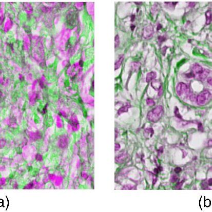 PDF Generative Adversarial Network Based Digital Stain Conversion For Generating RGB EVG