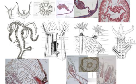 Schaubild „cnidaria 1 Anthozoa“ Quizlet