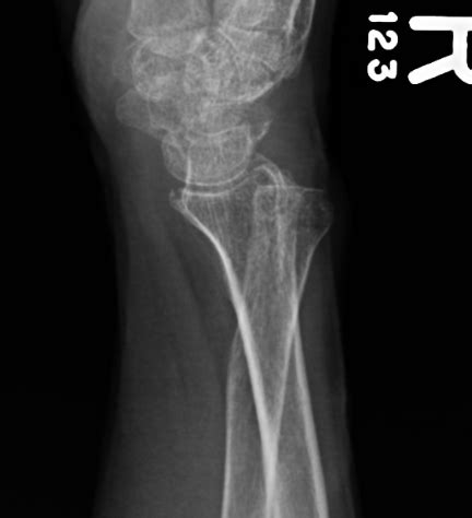 Druj Instability The Bone School