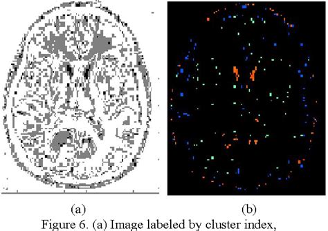 figure 6 from mri brain image segmentation using modified fuzzy c means