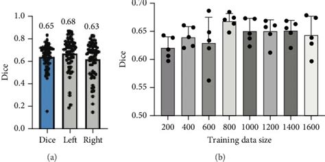 Automatic Segmentation Of The Cisternal Segment Of Trigeminal Nerve On Mri Using Deep Learning Pmc