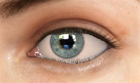 Entropion Treatment Options Fort Lauderdale Eye Institute
