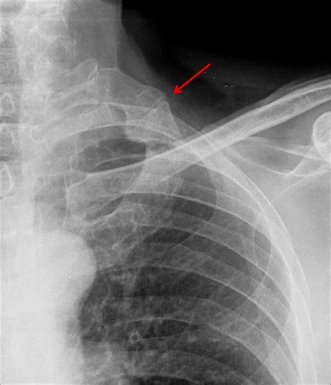 X Ng Kh P B M Sinh B I Gi Ng C Ha