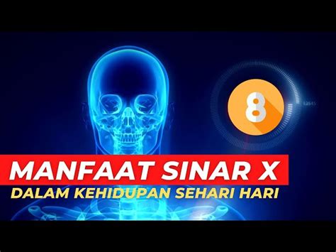 Manfaat Sinar X Yang Jarang Diketahui Anda Harus Tahu