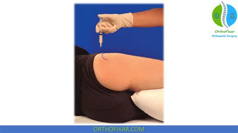 Hip Injection Technique Easily Step By Step Orthofixar