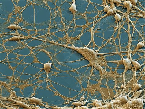 Neural Progenitor Cells Sem Stock Image G442 0479 Science Photo Library