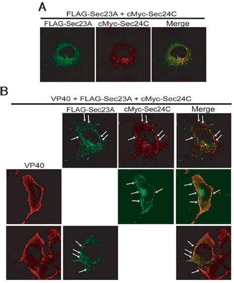 Ebola Virus Matrix Vp40 Protein Uses The Copii Transport System For Its