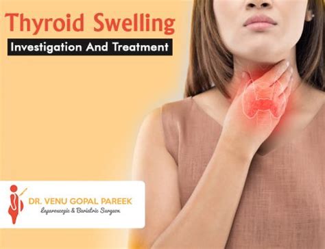 Thyroid Swelling Treatment Archives Dr V Pareek