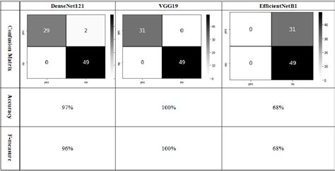 Figure 1 From Fine Tuning Cnn For Covid 19 Patterns Detection From