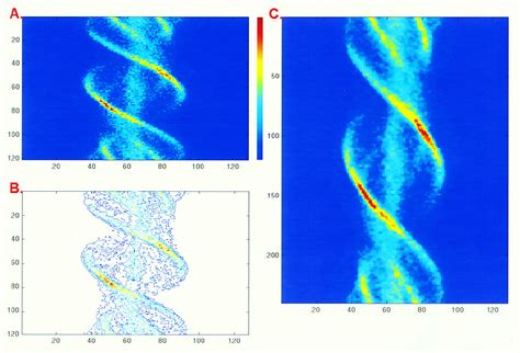 Streak Artifact Reduction In Filtered Backprojection Using A Level Line