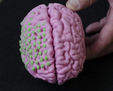 3d Printing For Intracranial Eeg Electrodes Localization