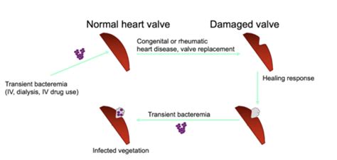 Staphylococci Flashcards Quizlet
