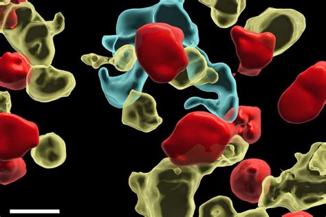 A Turning Point For Cancer Treatment Monocytes Boost T Cells In