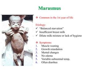 Malnutrition Consequences Causes Prevention And Control Pptx