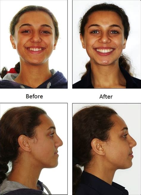 University Of Bristol Dental Hospital What We Do University
