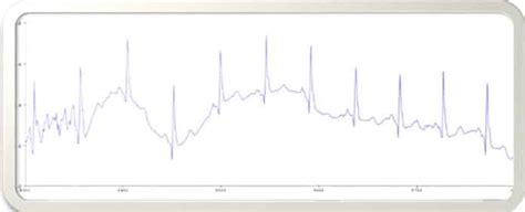 Real Time Handheld ECG Display