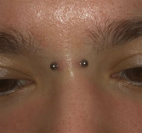Is My Bridge Piercing Starting To Reject Or Is It Just Irritated Got