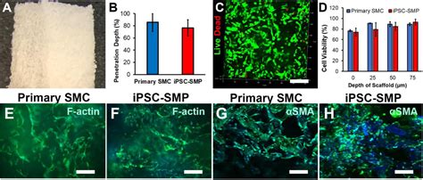 Peri Adventitial Delivery Of Smooth Muscle Cells In Porous Collagen Scaffolds For Treatment Of